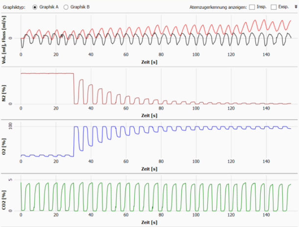 Multiple Breath Washout Test Archives - ECO MEDICS
